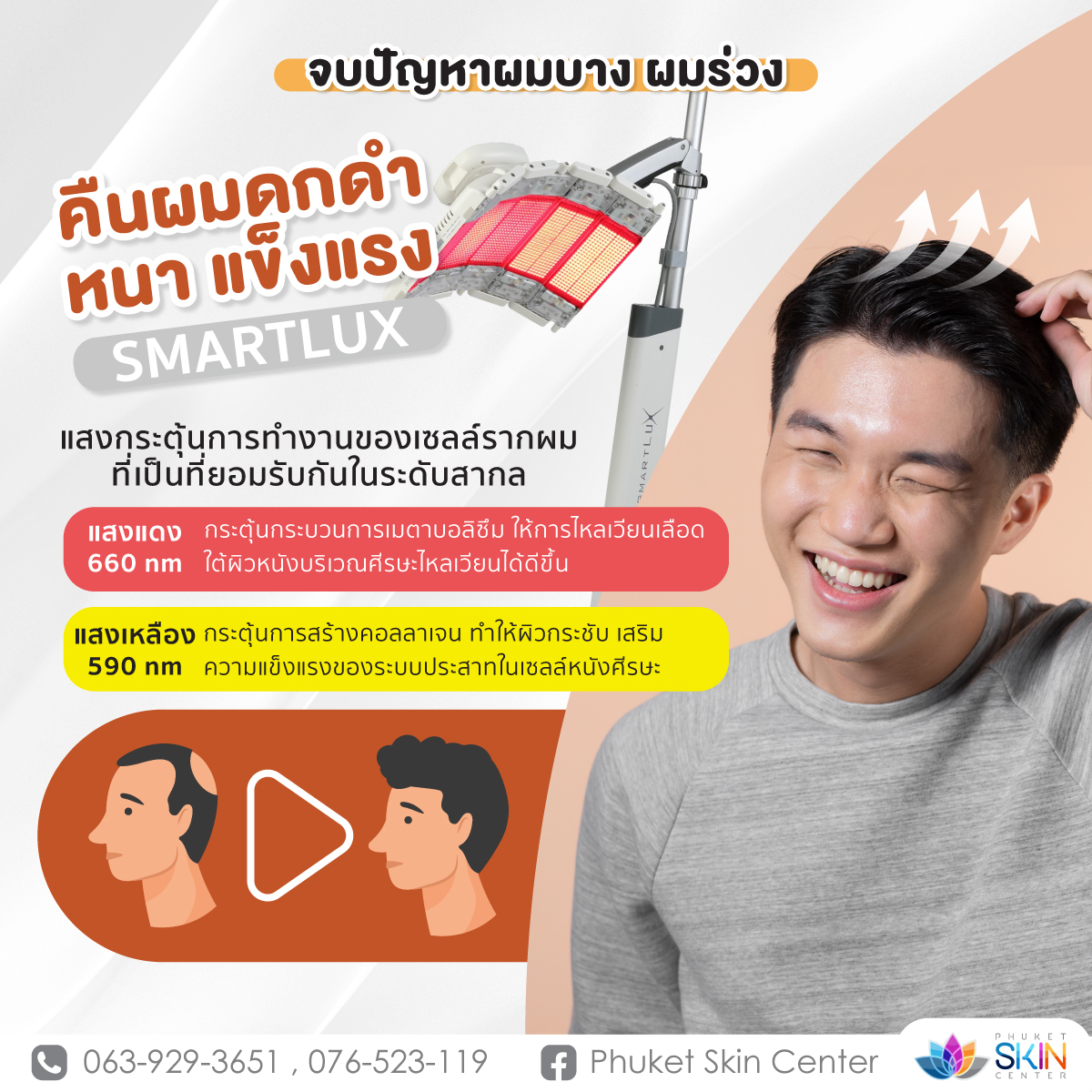 Smartlux คืนผมสวย แข็งแรง สุขภาพดี